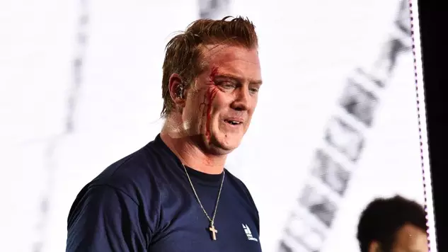 Josh Homme ຂໍອະໄພອີກຄັ້ງສຳລັບຊ່າງພາບຄອນເສີດເຕະ